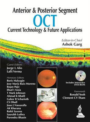 Anterior & Posterior Segment OCT: Current Technology & Future ...