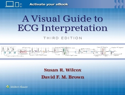 A Visual Guide to ECG Interpretation | Susan Renee Wilcox Book | Pre ...